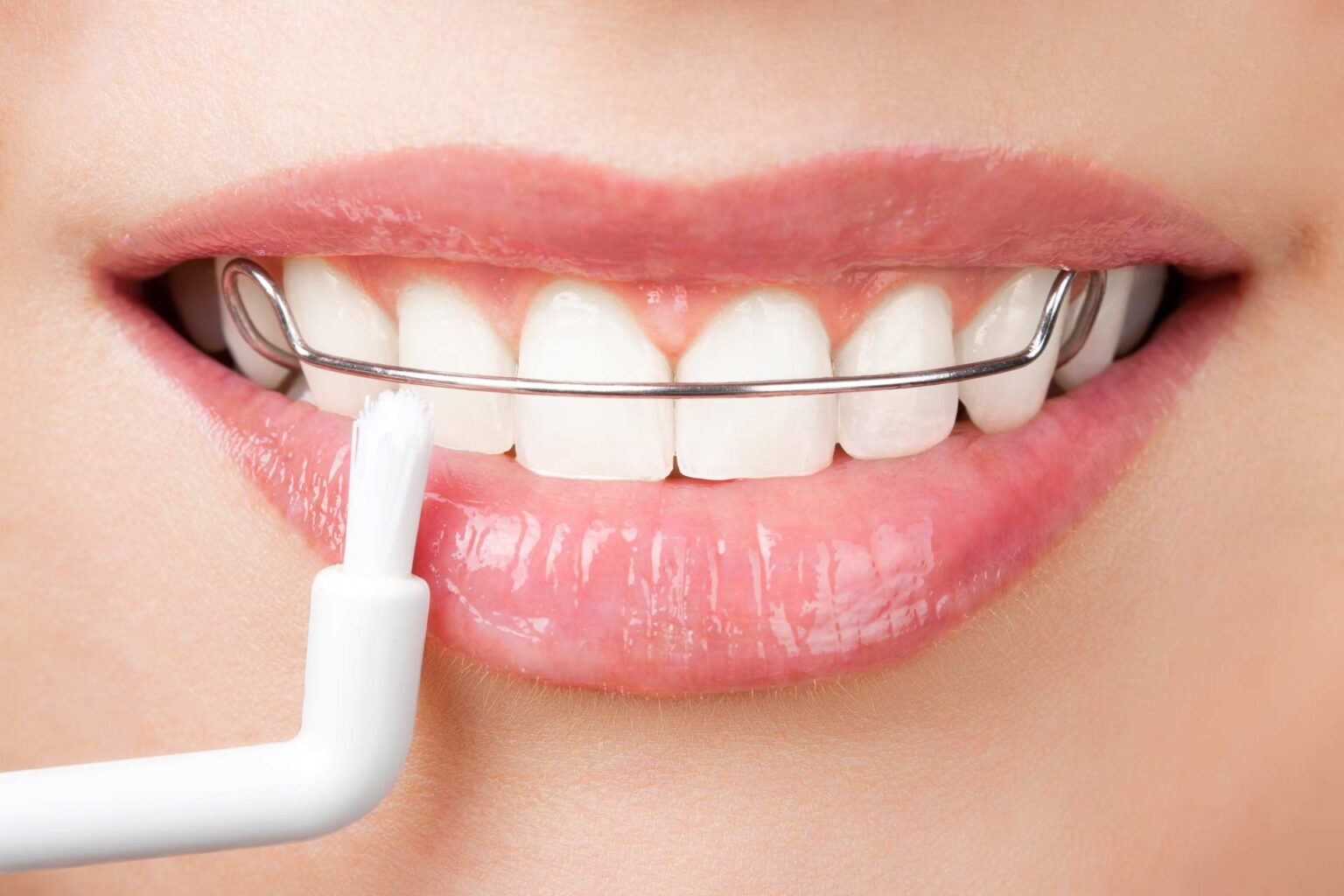 What to Expect at Your First Orthodontist Appointment | Orthotime
